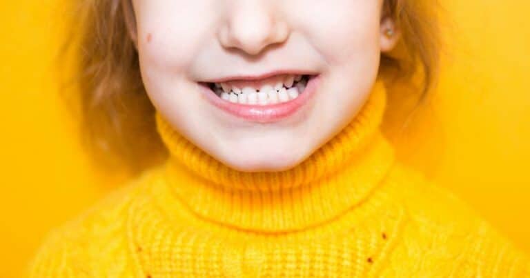 Underbite vs. Overbite in Children: What It All Means