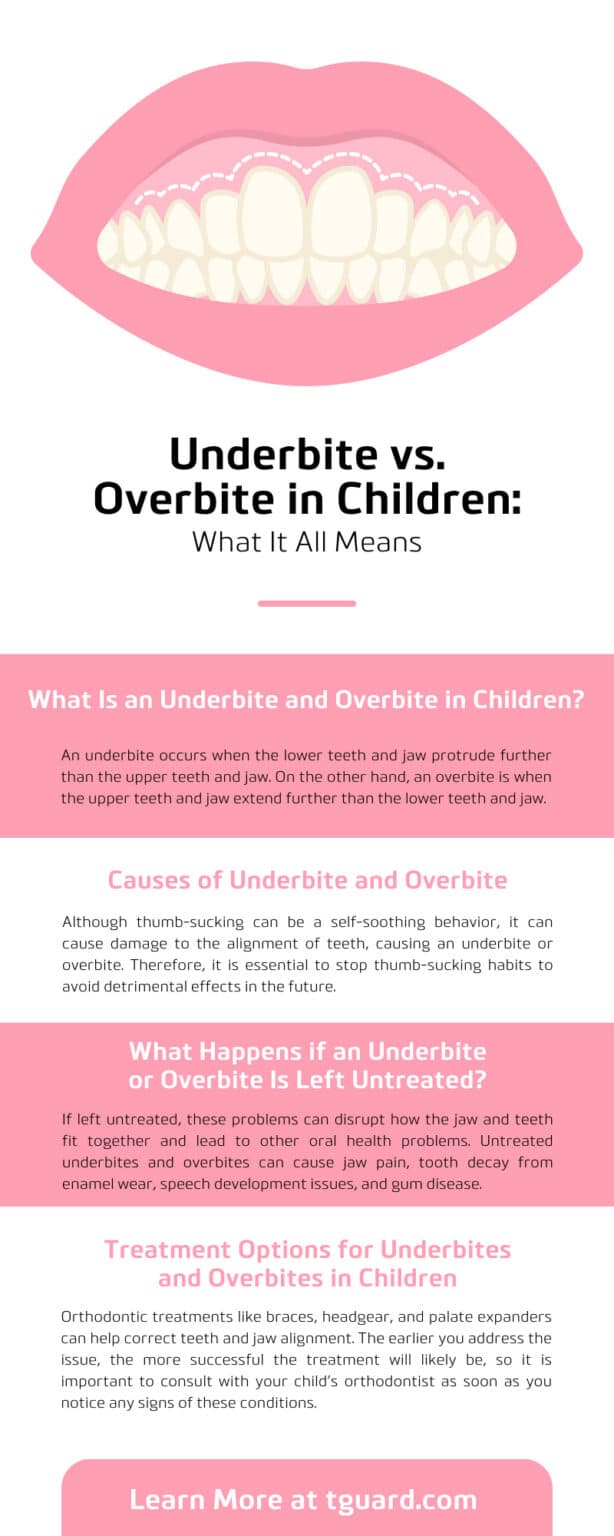 Underbite vs. Overbite in Children: What It All Means